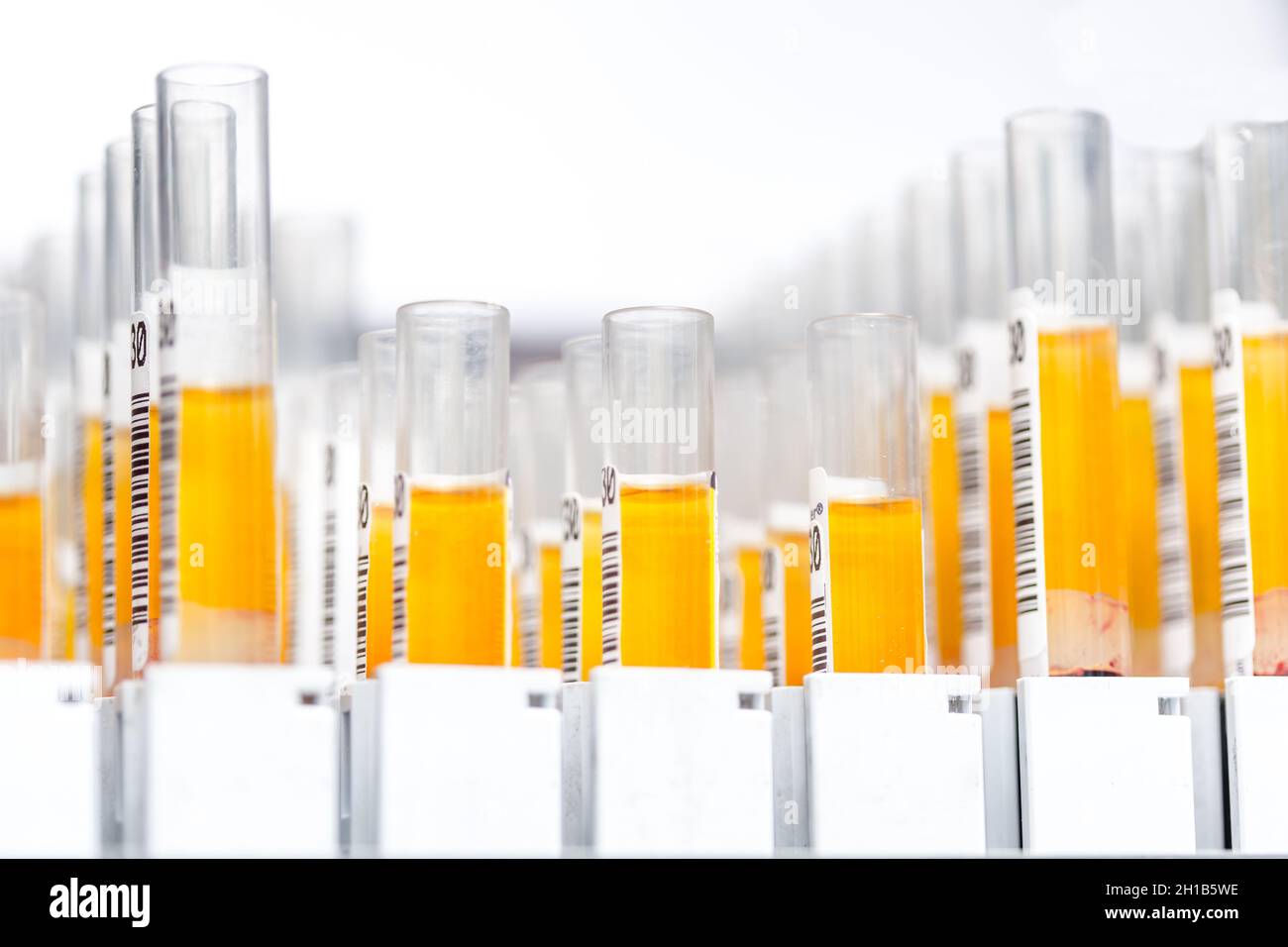 Laboratory glass test tubes filled with orange liquid for an experiment ...