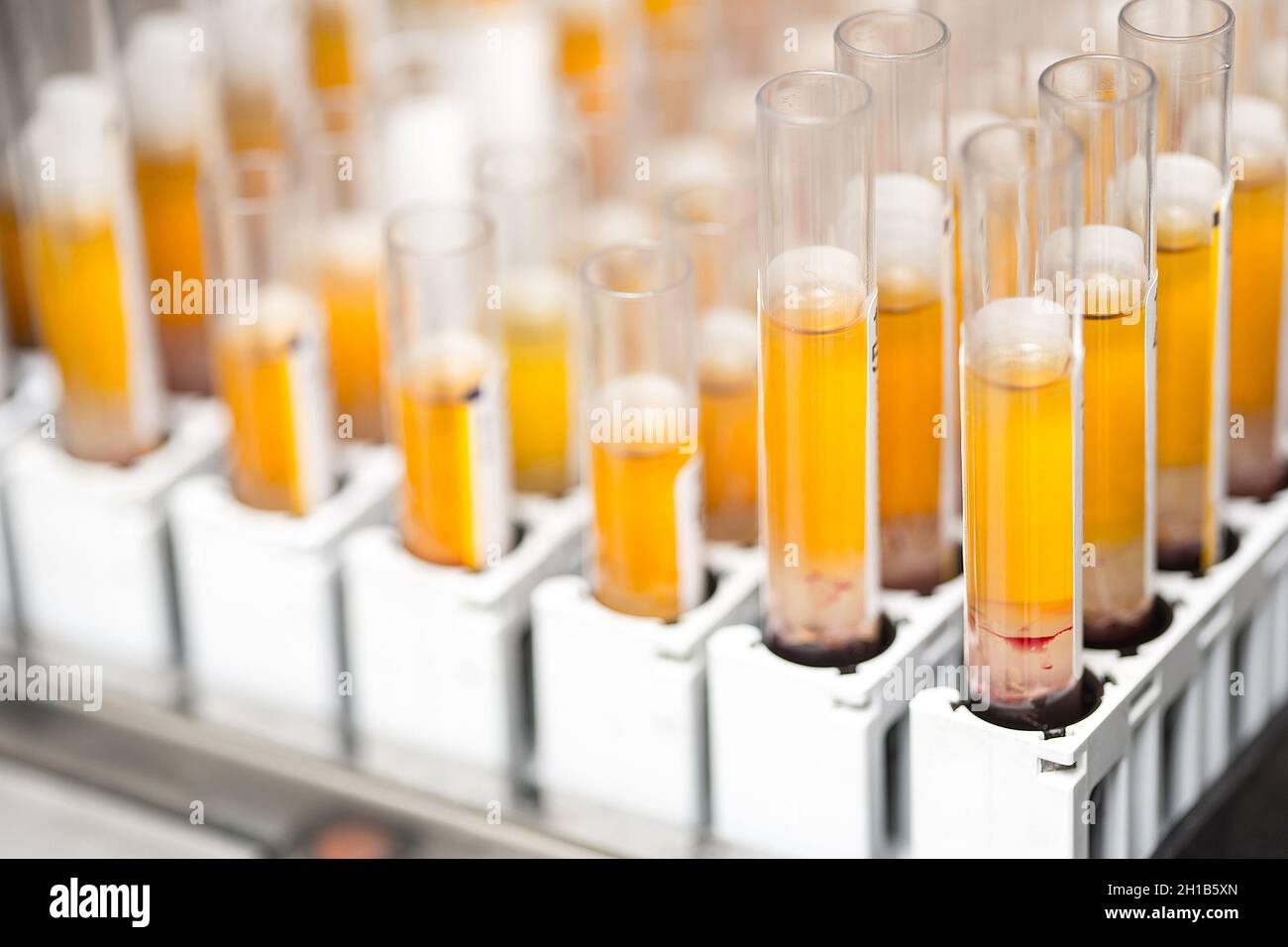 Laboratory glass test tubes filled with orange liquid for an experiment ...