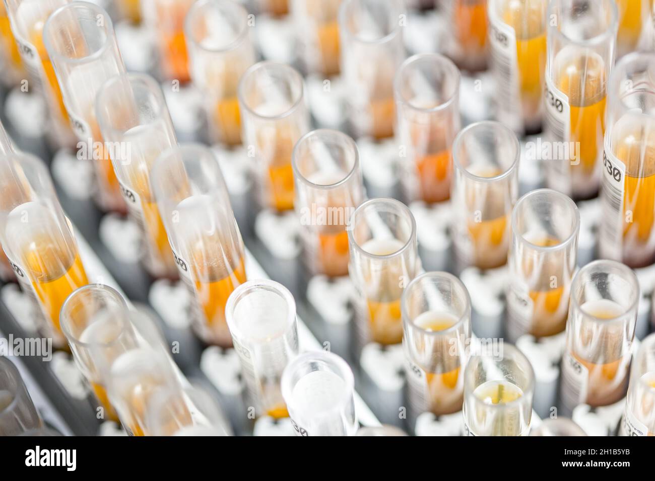 Laboratory glass test tubes filled with orange liquid for an experiment ...