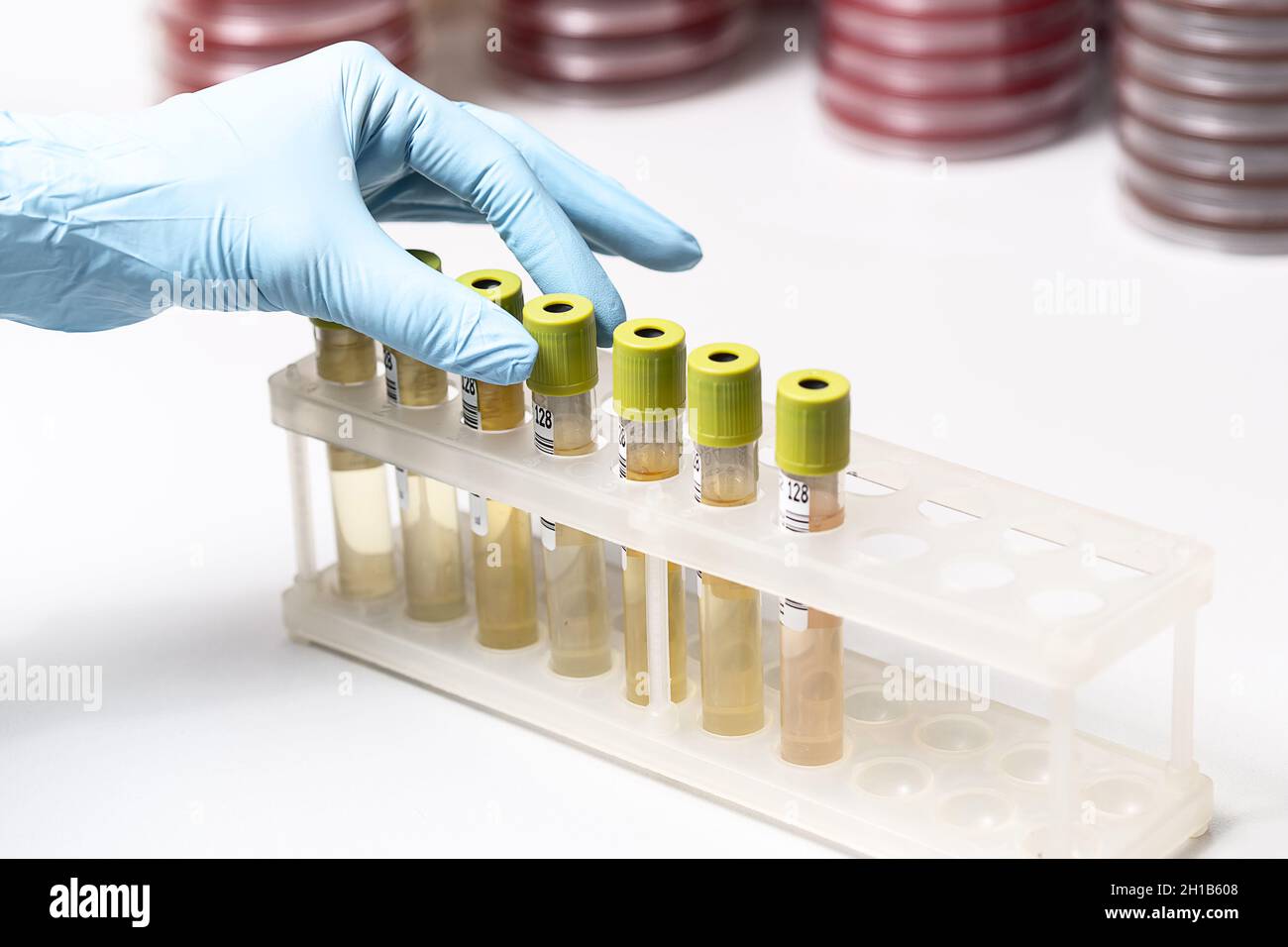 Test-tubes with yellow liquid in the laboratory Stock Photo - Alamy