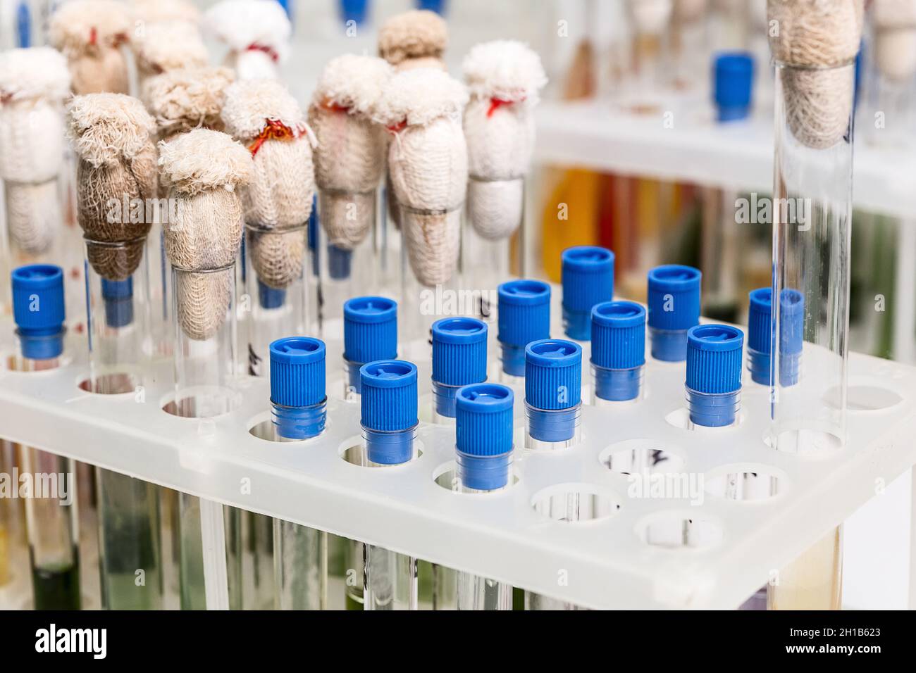 Medical tray lid hi-res stock photography and images - Alamy