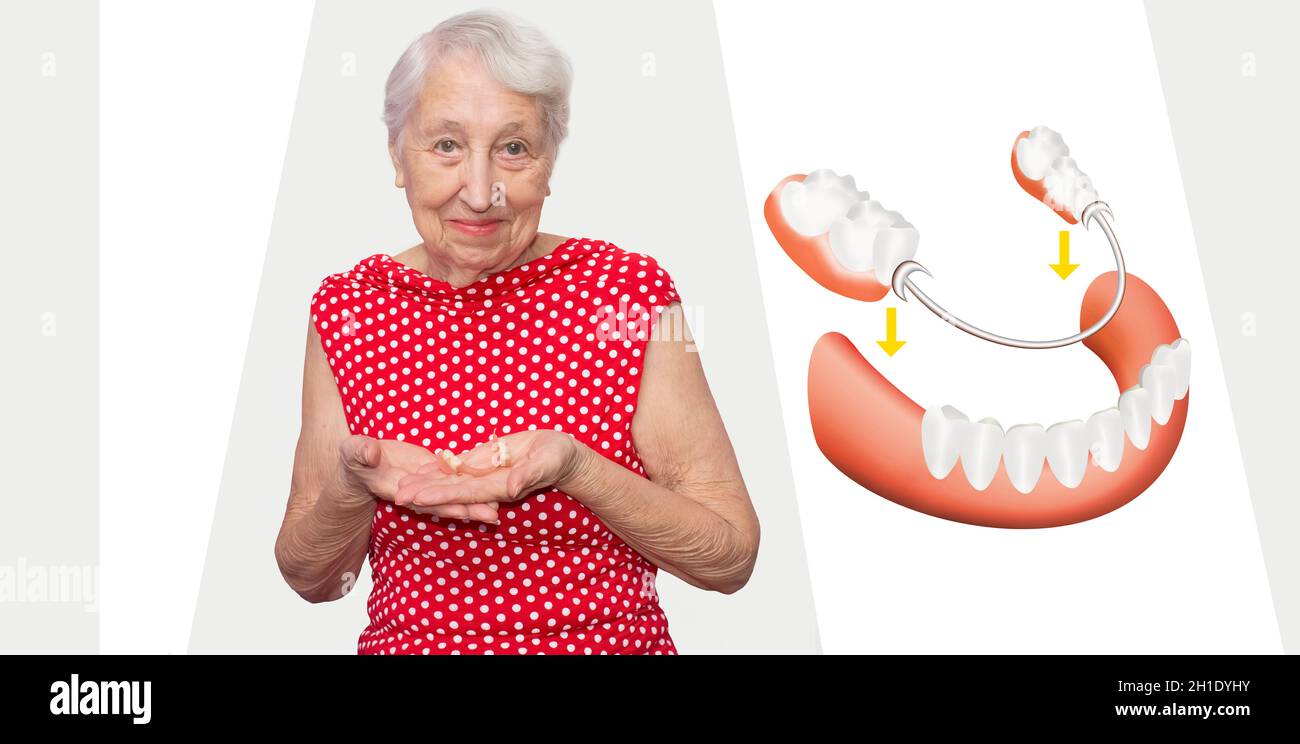 Removable flexible nylon denture on senior female hands. Dental ...