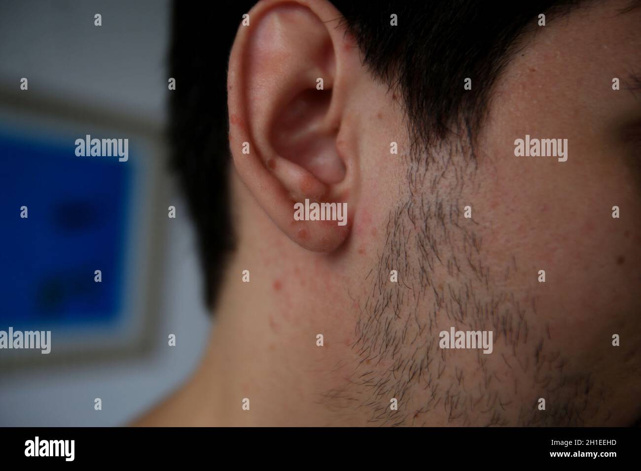 salvador, bahia / brazil - april 11, 2019: man shows body parts ...