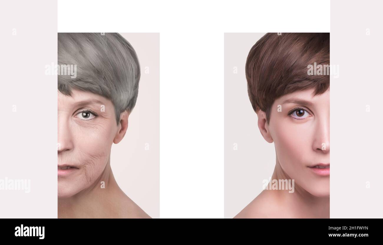 Anti-aging, beauty treatment, aging and youth, lifting, skincare ...