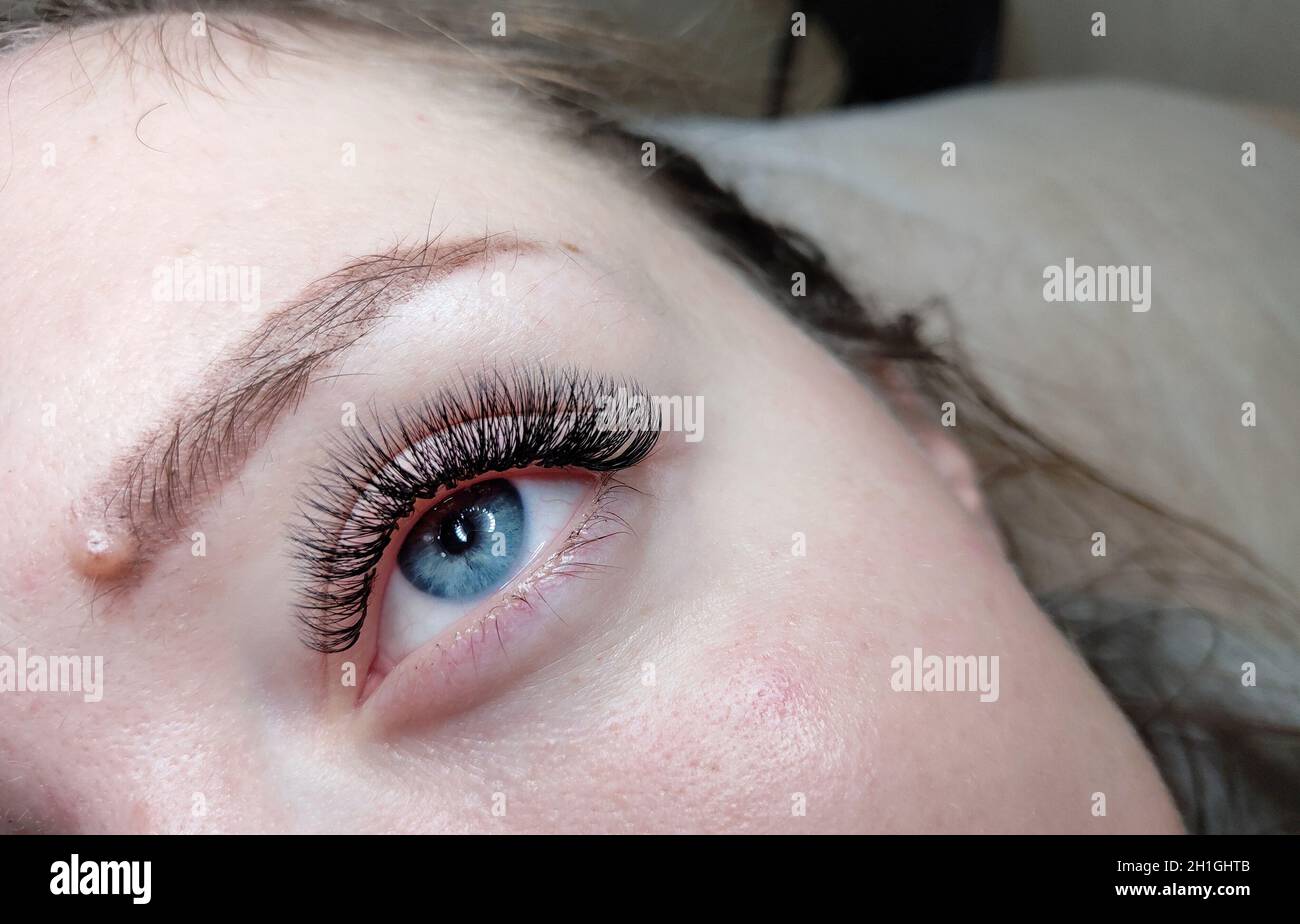 Drooping eye hi-res stock photography and images - Alamy