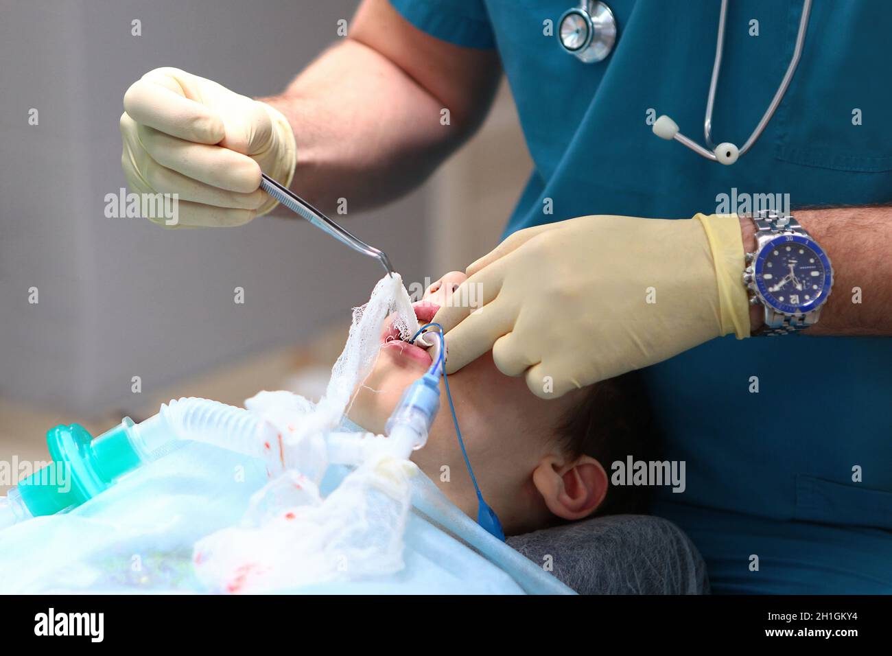The end of the operation. The child is taken out of anesthesia. The ...