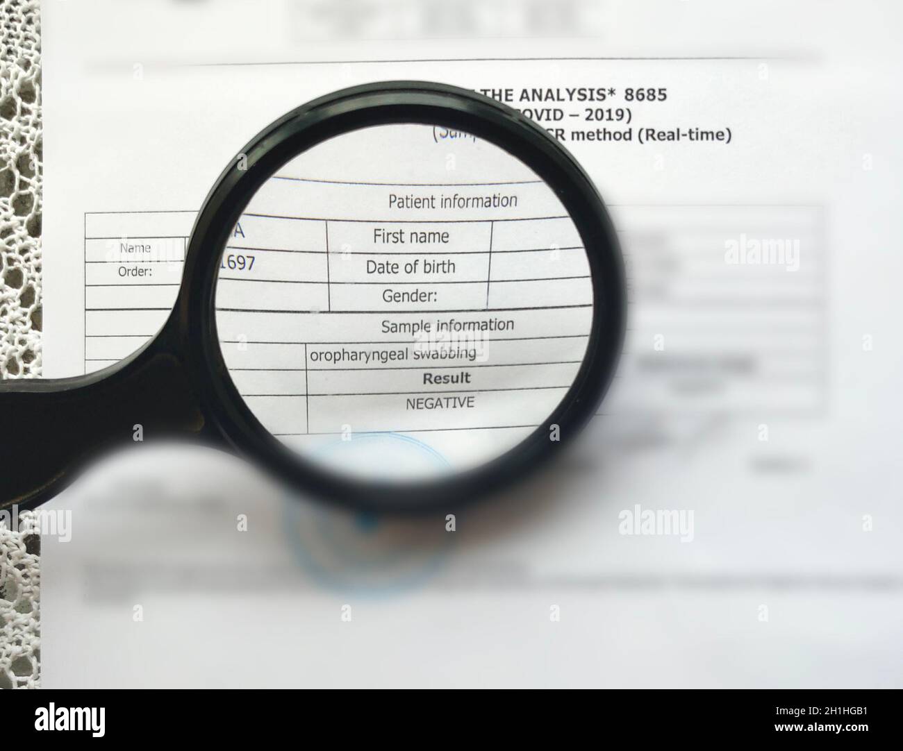 The result of the analysis - coronavirus COVID-19 qualitative RNA ...