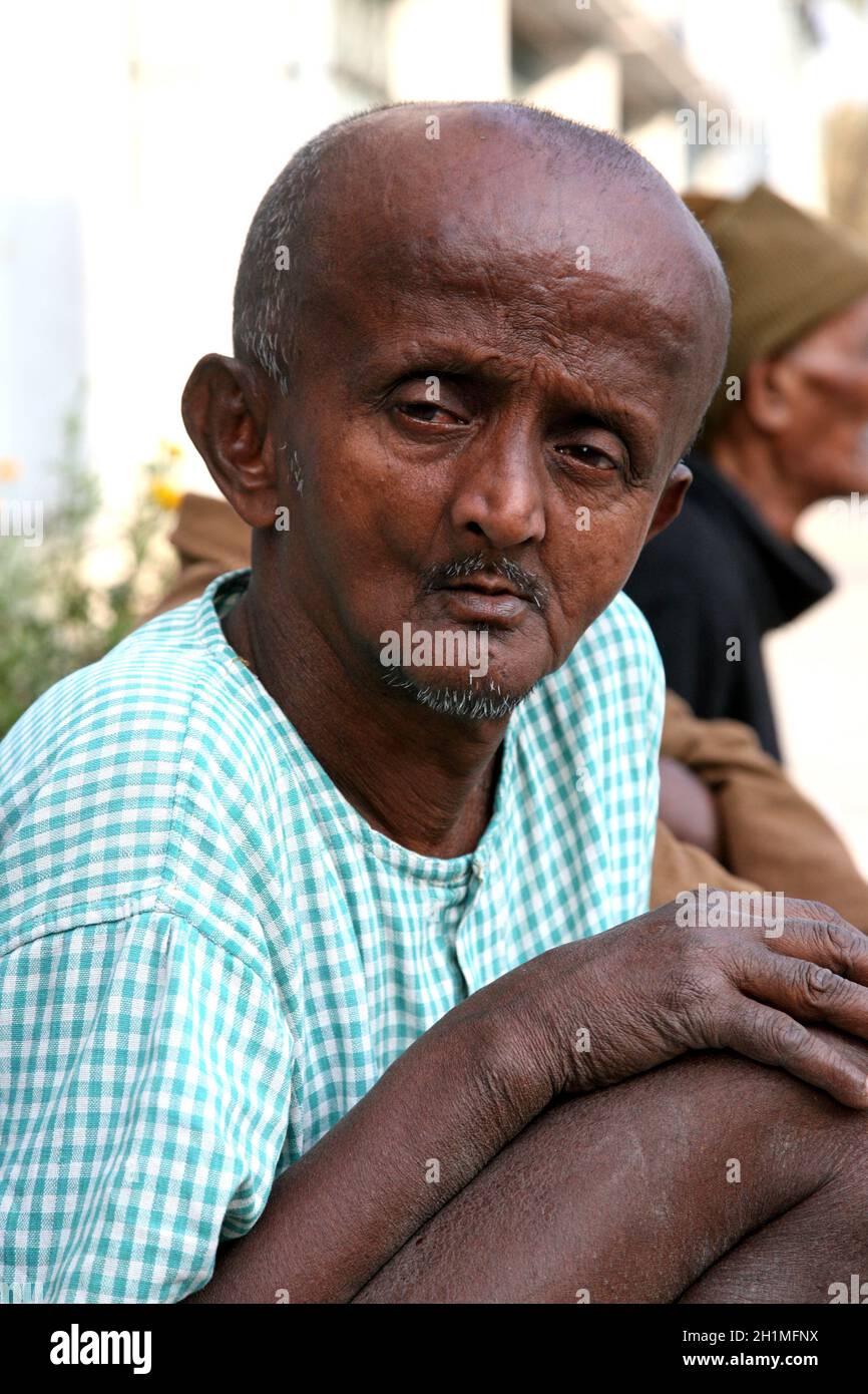 Streets of Kolkata. Portrait of sick man Stock Photo - Alamy