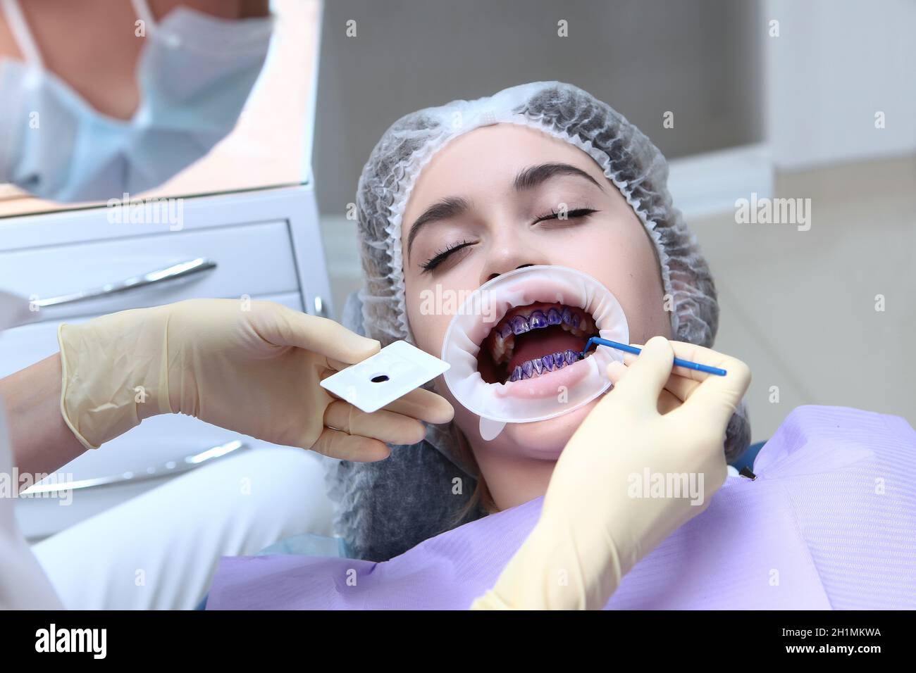 The dentist applies a purple gel to the patient's teeth before ...