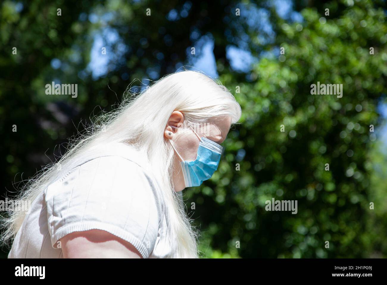 Albino face close up hi-res stock photography and images - Alamy