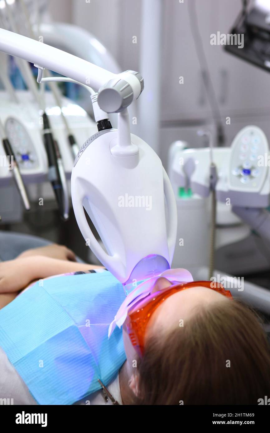 Teeth whitening in dental clinic. Young woman whitens her teeth with ...
