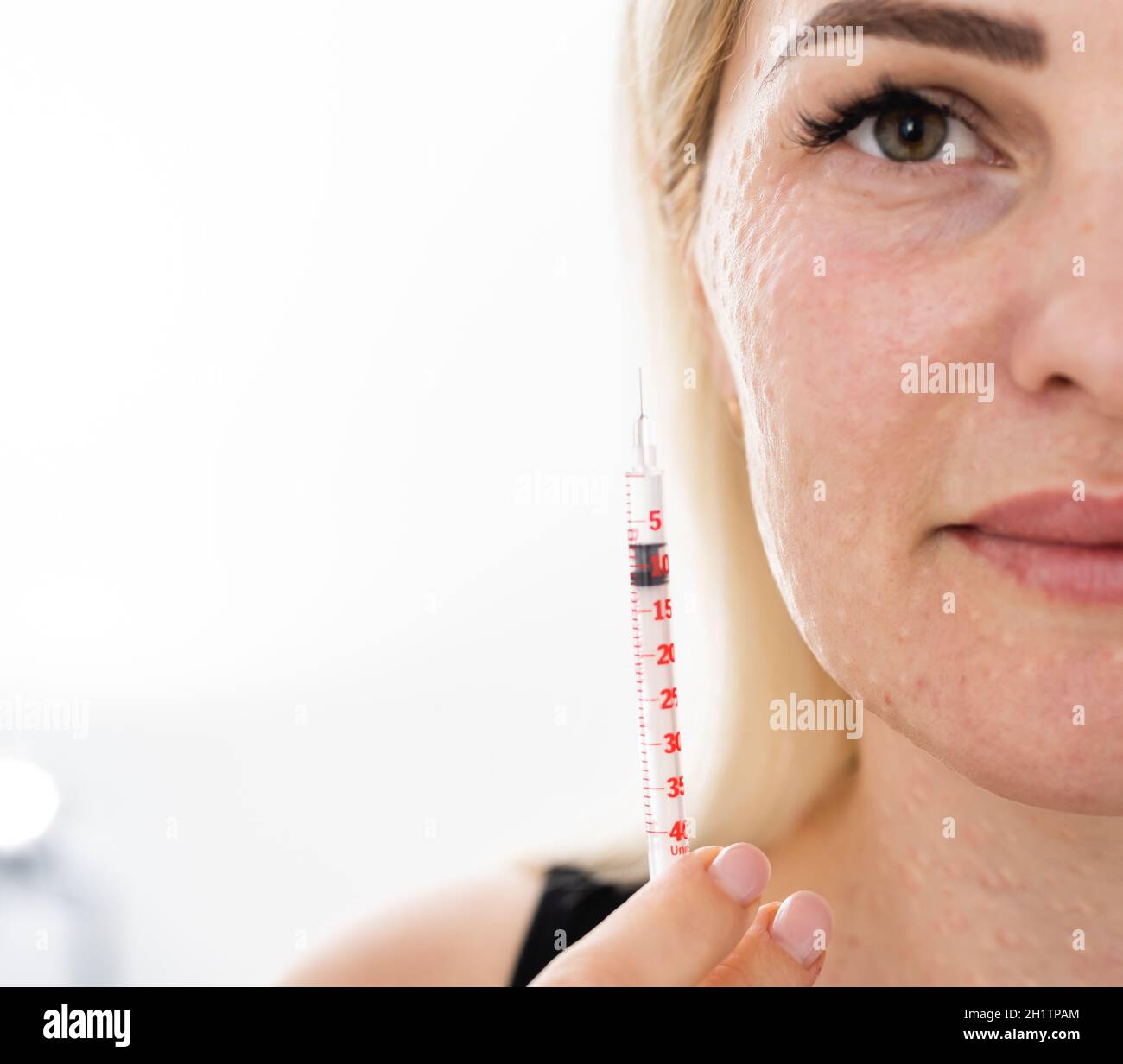 Real skin Biorevitalization on white background. Traces of ...