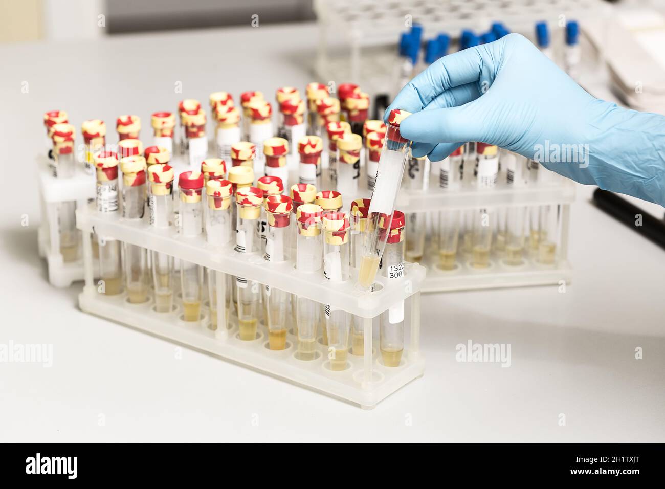 A chemical sample bottle. Centrifuge. A test tube vial sets for ...