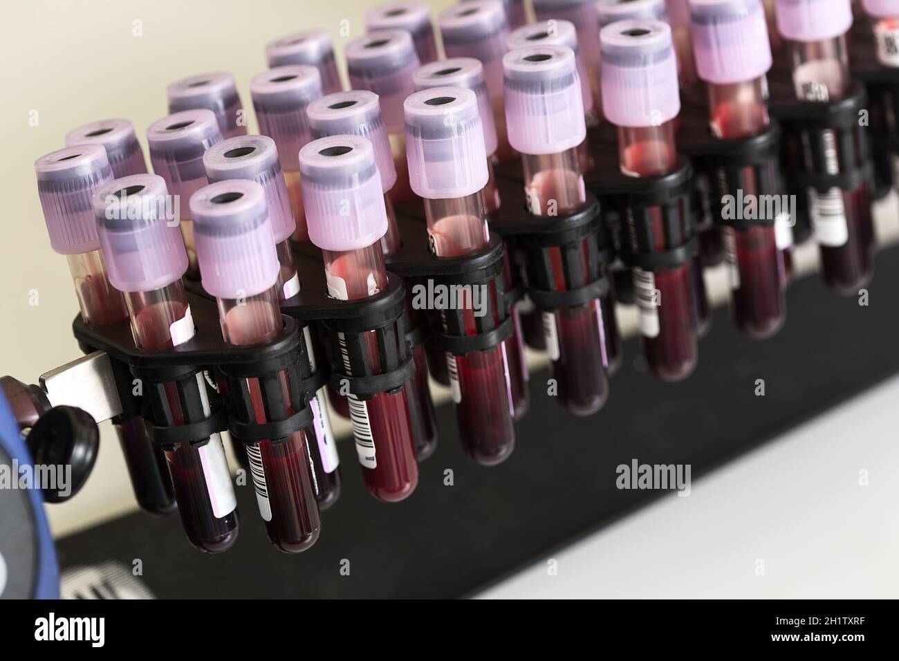 Tube blood sample in a medical examination Stock Photo - Alamy
