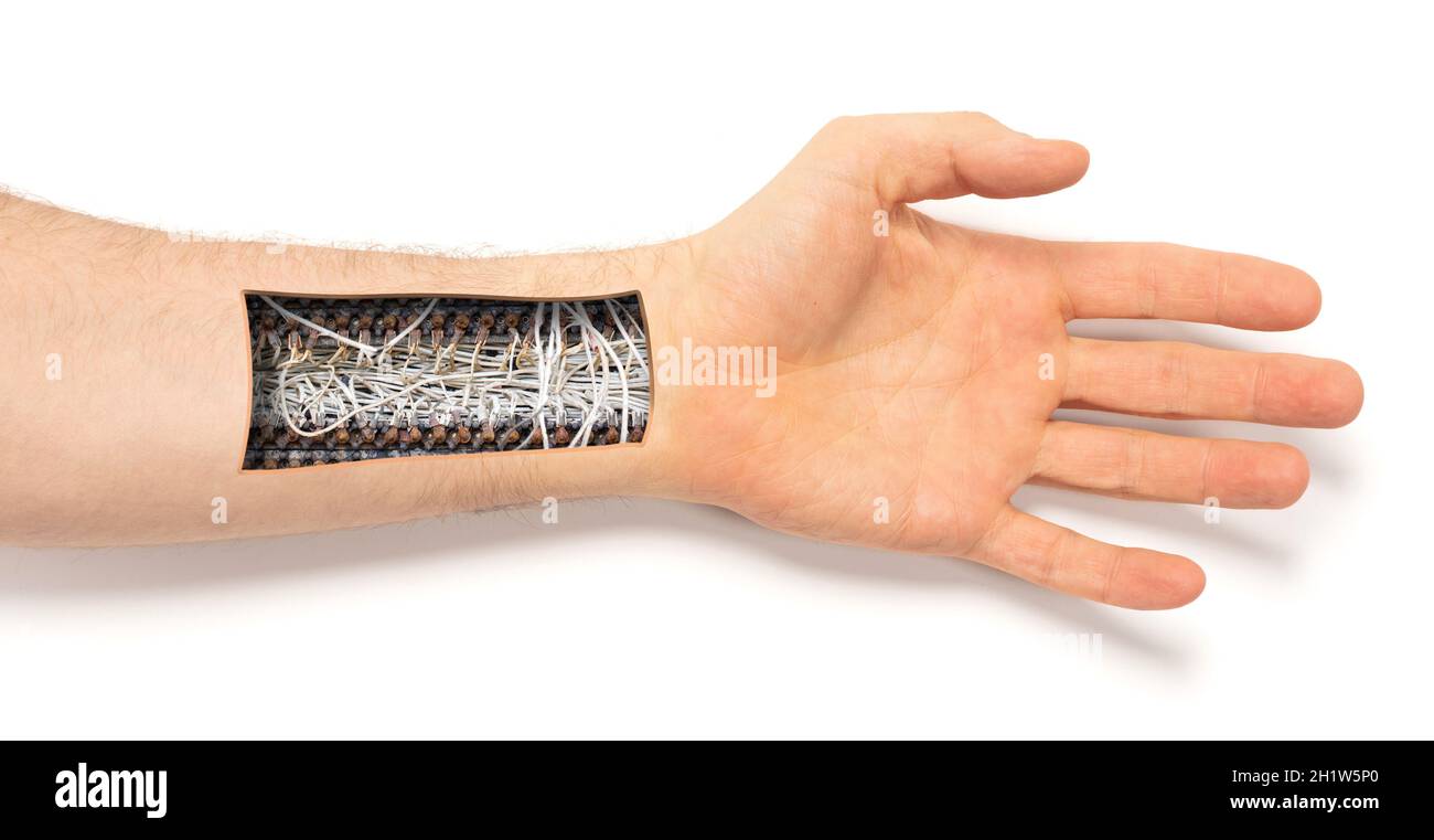 Robot hand inside human hand - Prosthesis concept, isolated on white ...