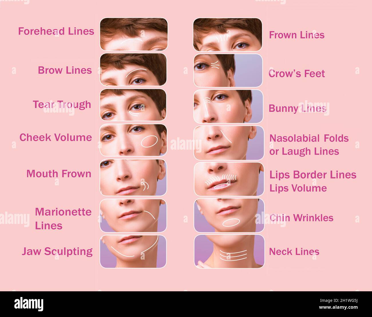 Female Nose Types Chart