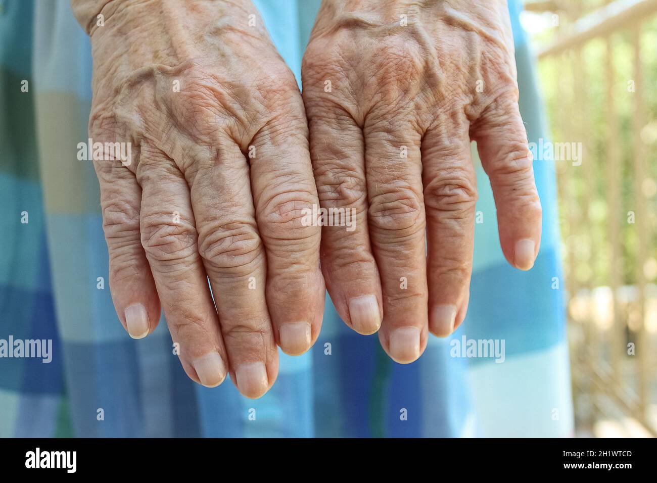 Senior woman's hand at home. Aging process Stock Photo - Alamy