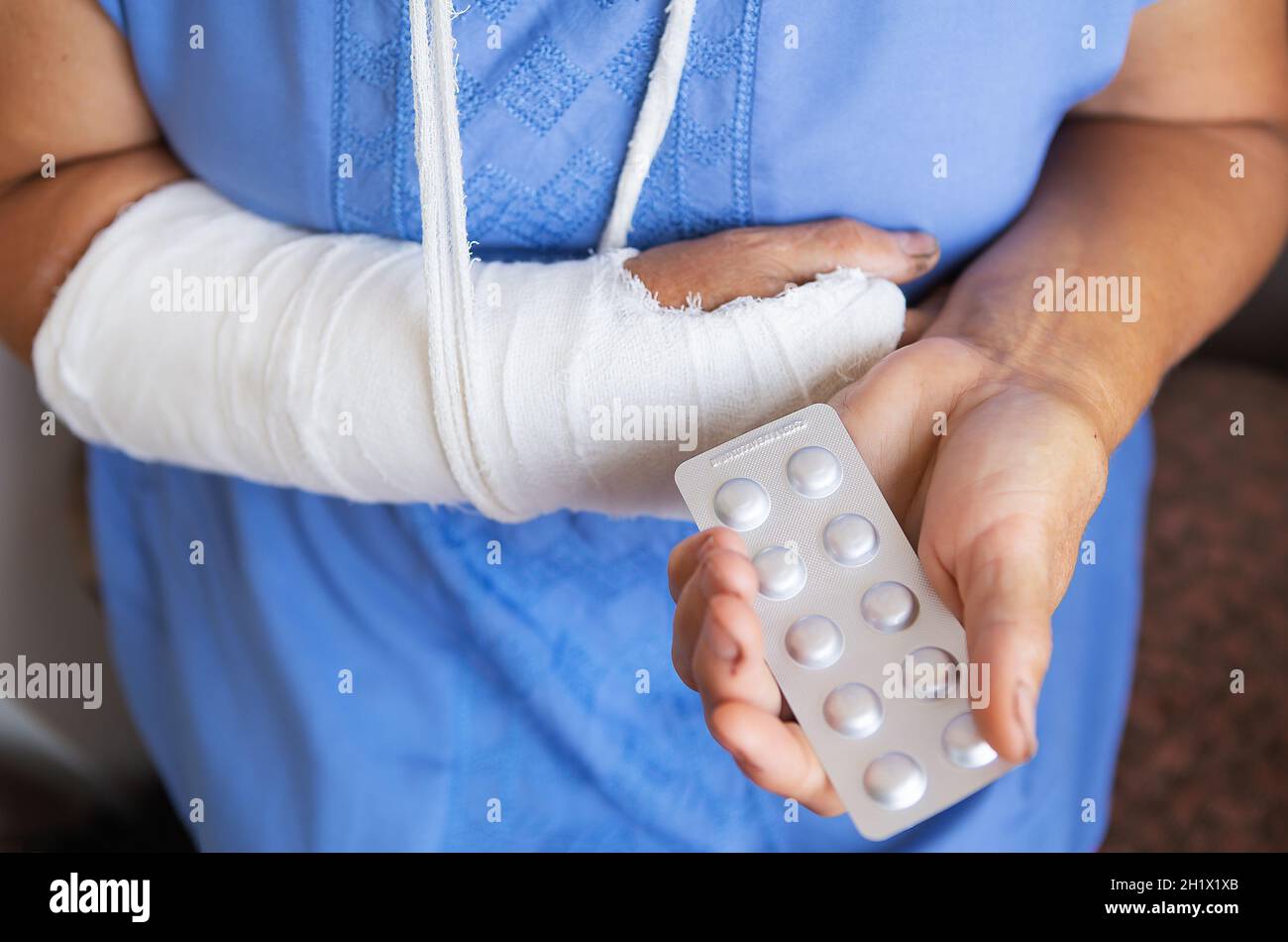 Woman arm cast hi-res stock photography and images - Alamy