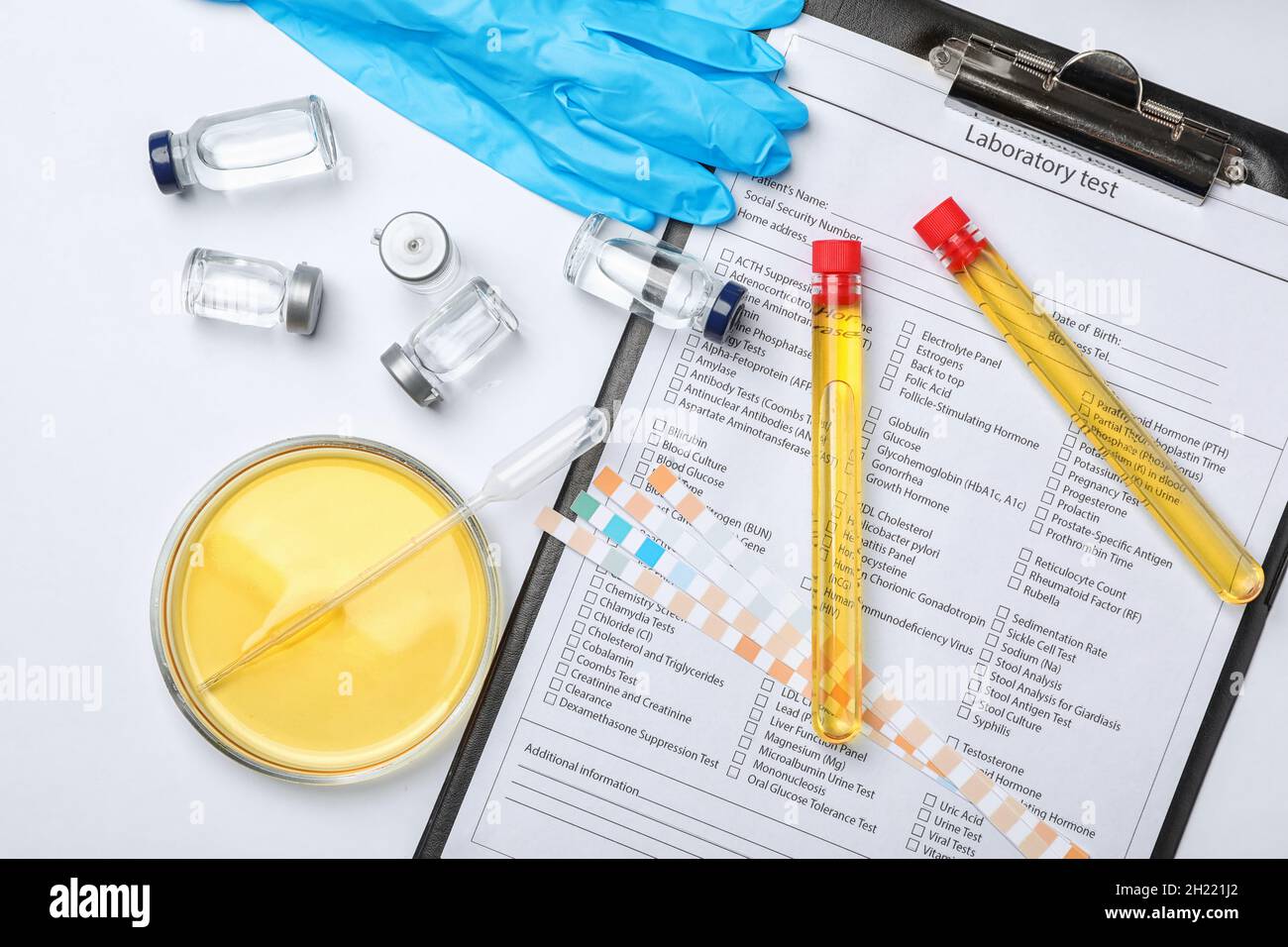 Flat lay composition with laboratory equipment and urine samples on ...