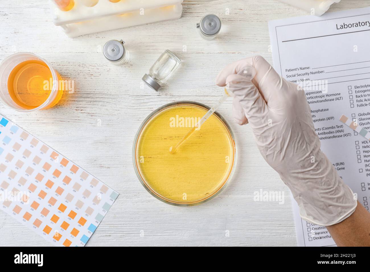 Laboratory worker taking urine sample from dish at table, top view ...