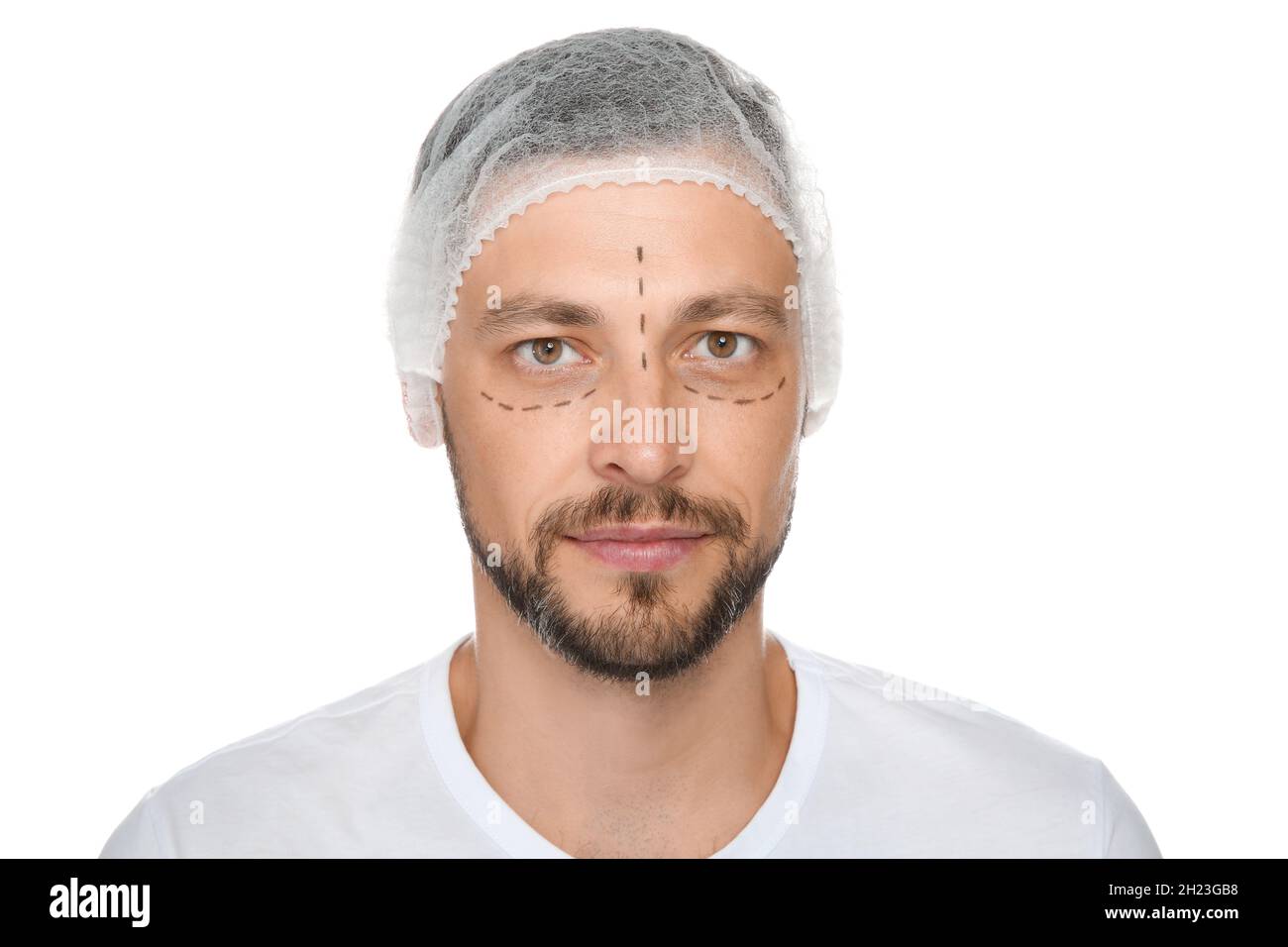 Man face surgery marks hi-res stock photography and images - Alamy