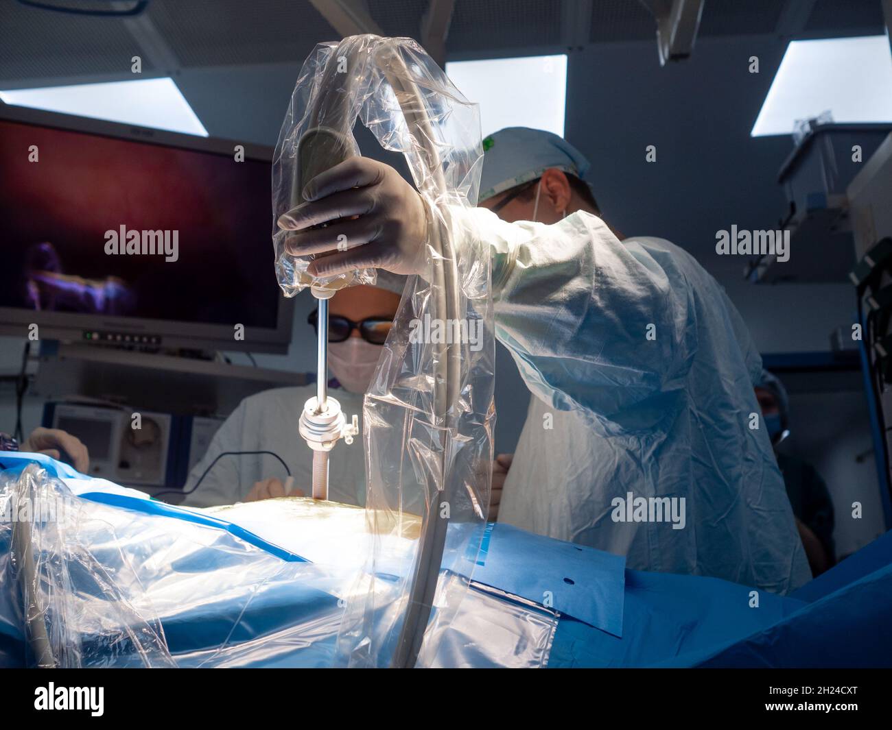 Selective focus on the surgeon's hand inserting an instrument into the ...
