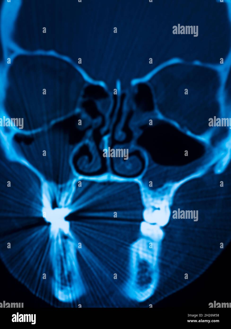 Xray scan skull nose medical exam results from hospital clinic Stock ...