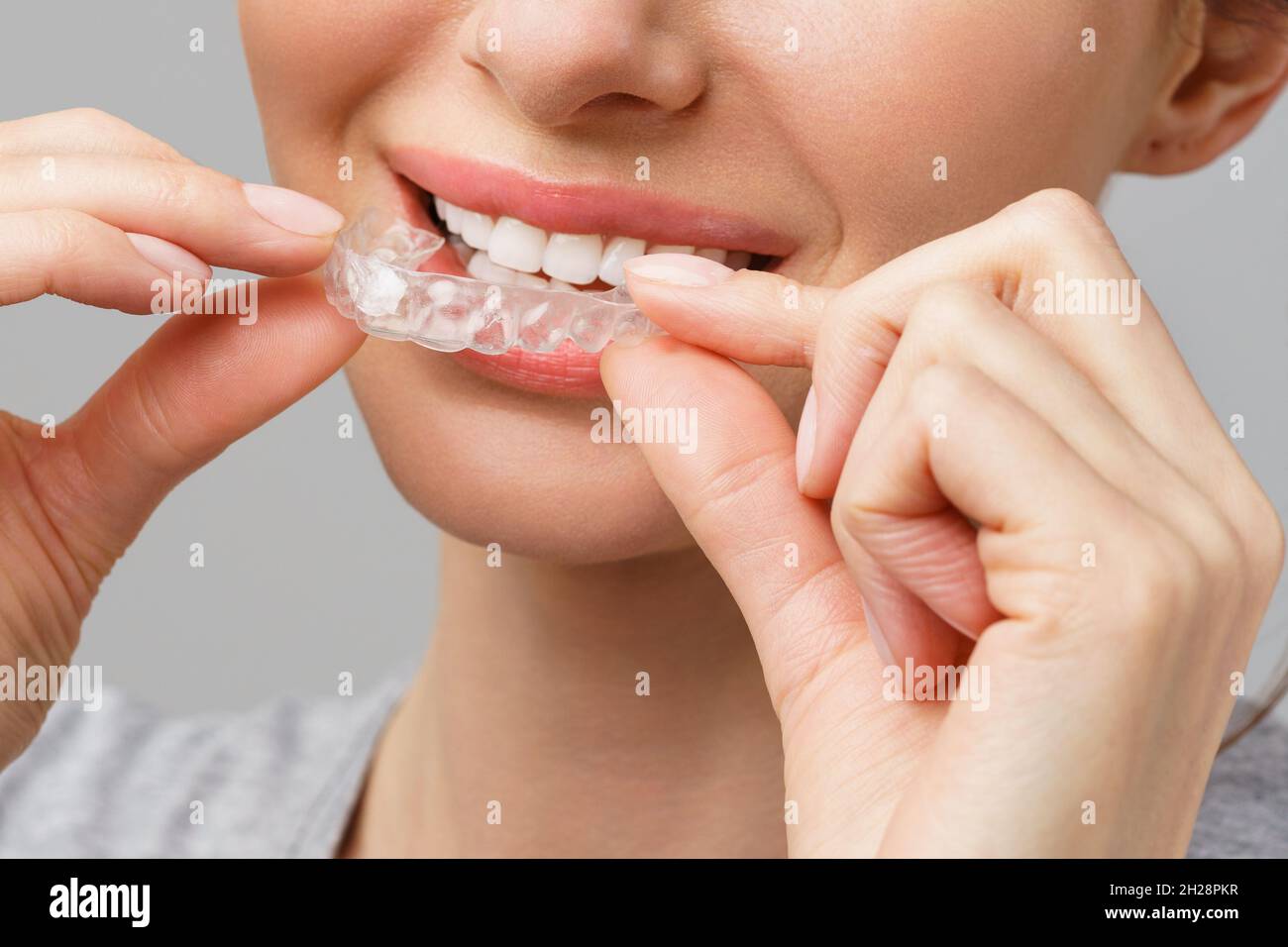 Tooth guard hi-res stock photography and images - Alamy