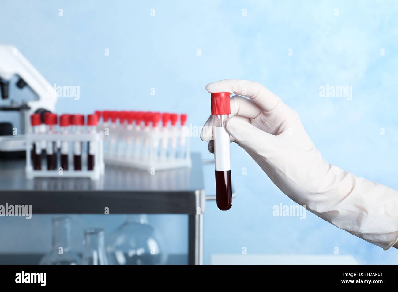 Allergenic testing hi-res stock photography and images - Alamy