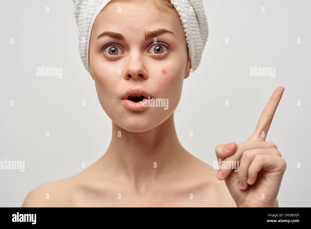 beautiful woman with a pimple on the face dermatology isolated ...