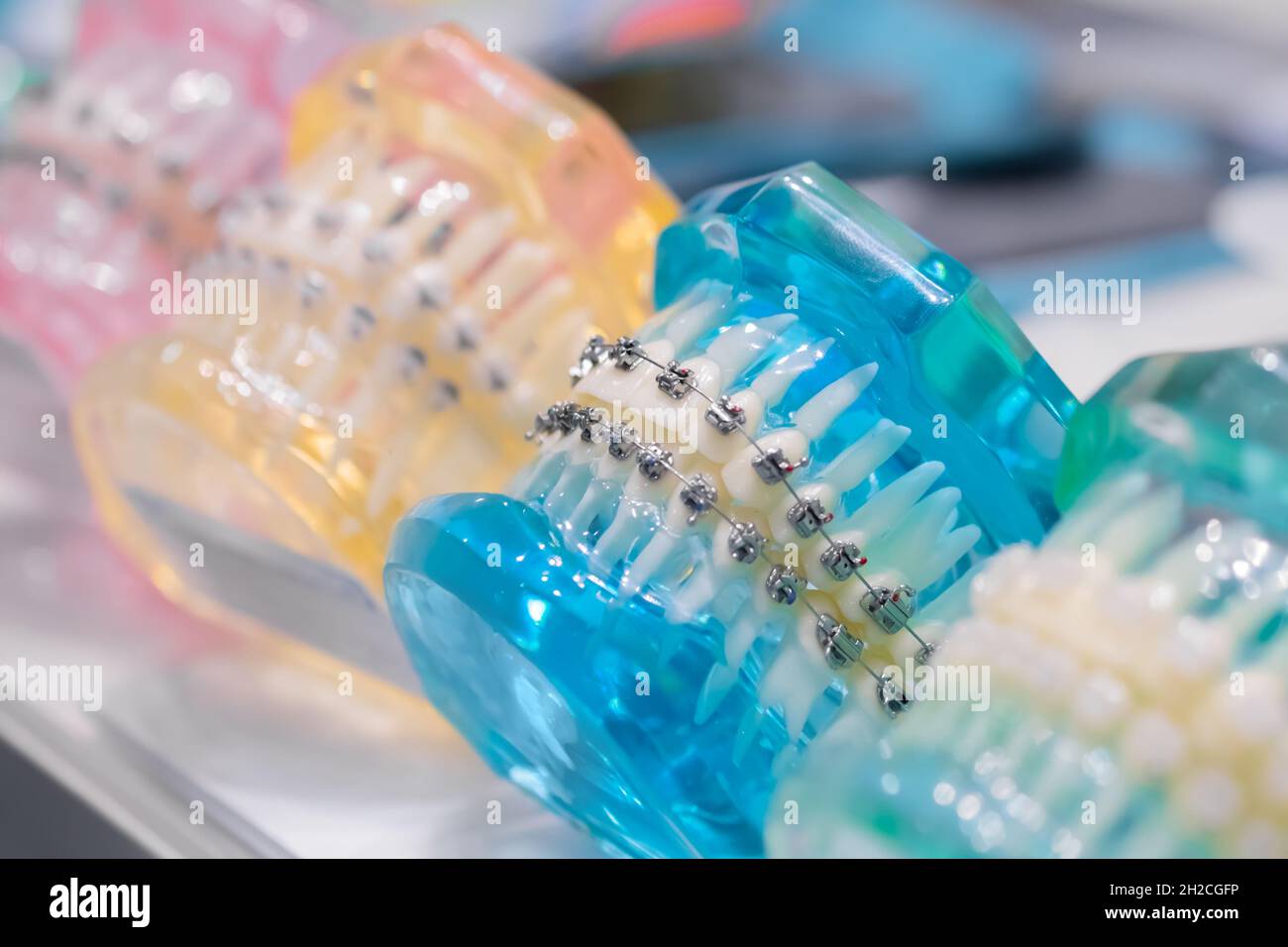 Transparent human jaws with orthodontic bracket, metal and ceramic ...