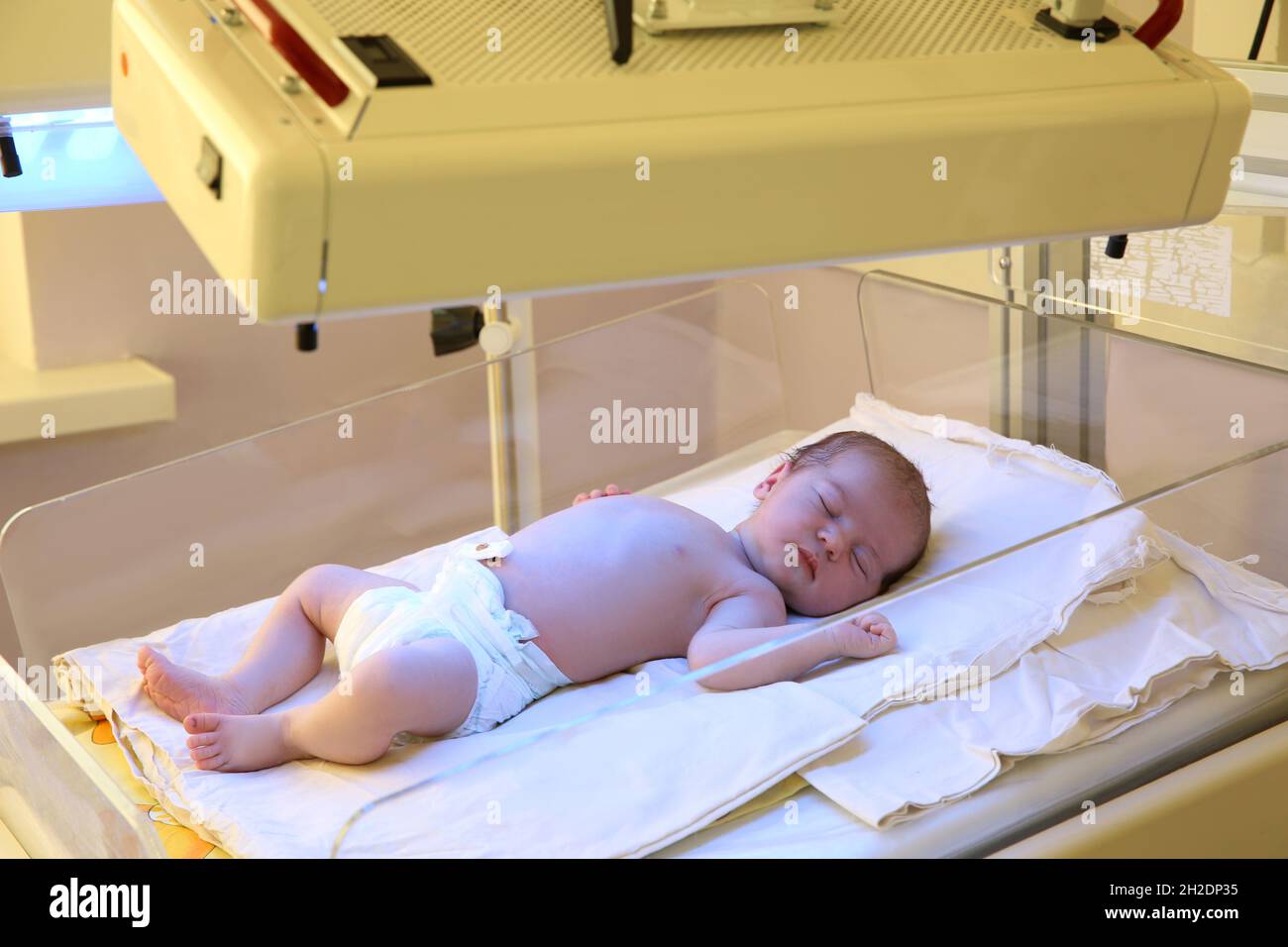 Newborn child under ultraviolet lamps in hospital Stock Photo - Alamy