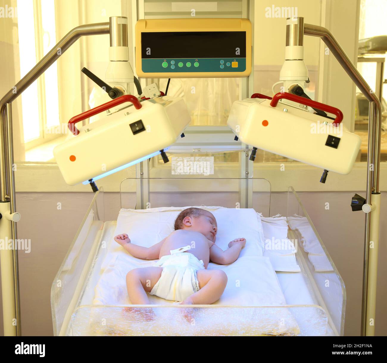 Newborn child under ultraviolet lamps in hospital Stock Photo - Alamy