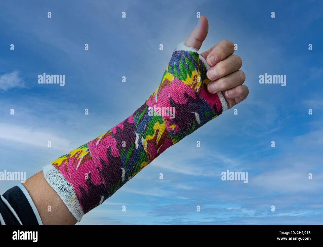 Woman broken arm hi-res stock photography and images - Alamy