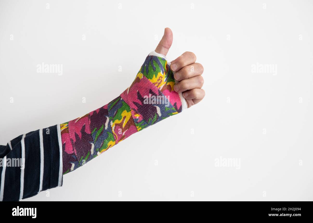 Woman broken arm cast hi-res stock photography and images - Alamy