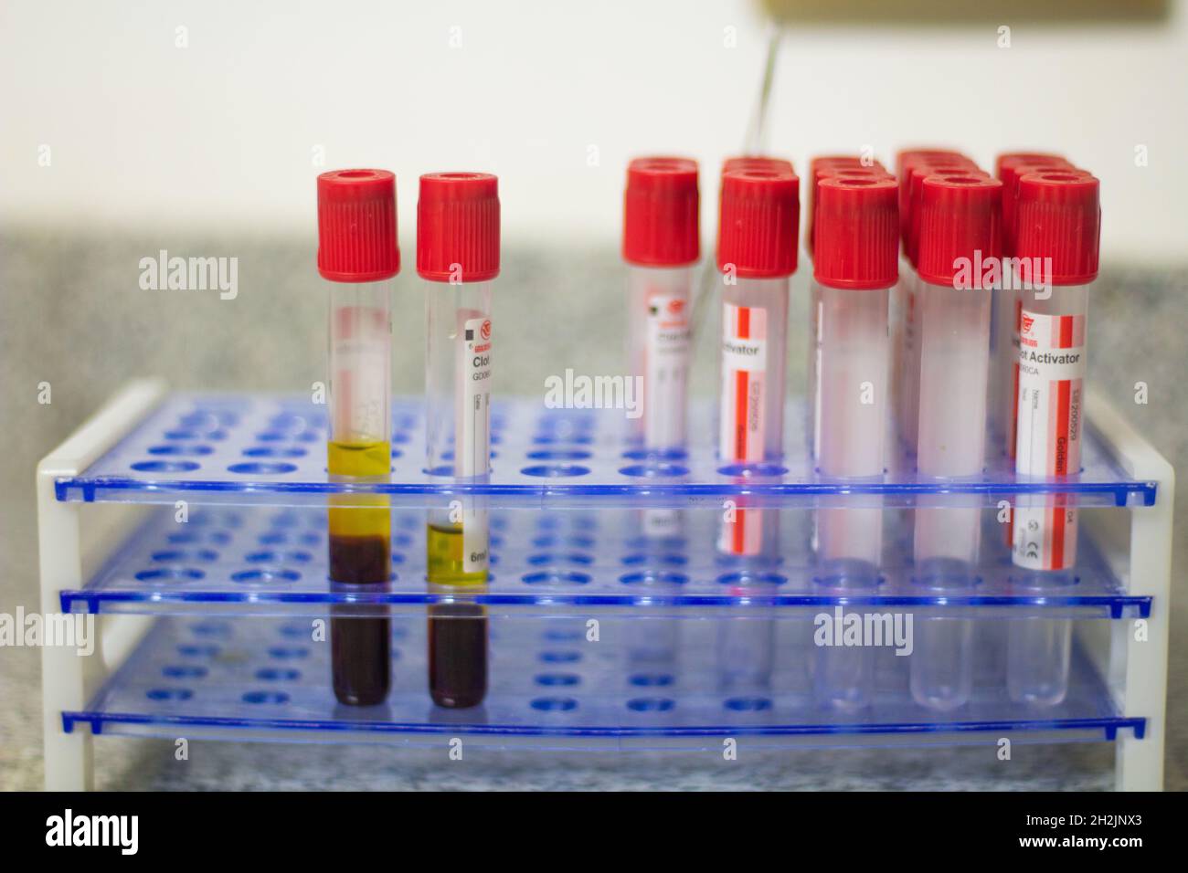 Selective focus on two blood test tubes in a lab put to analysis next ...