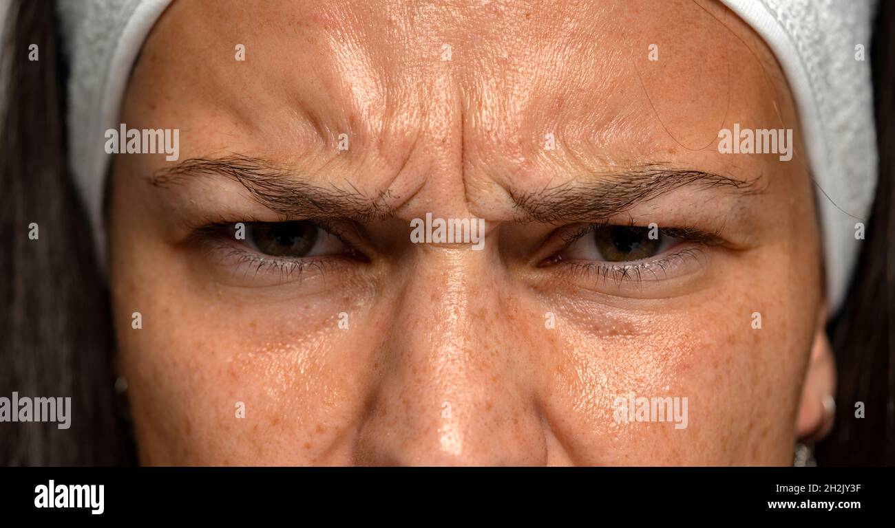 close up of a frowning woman with wrinkles between the eyebrows Stock ...