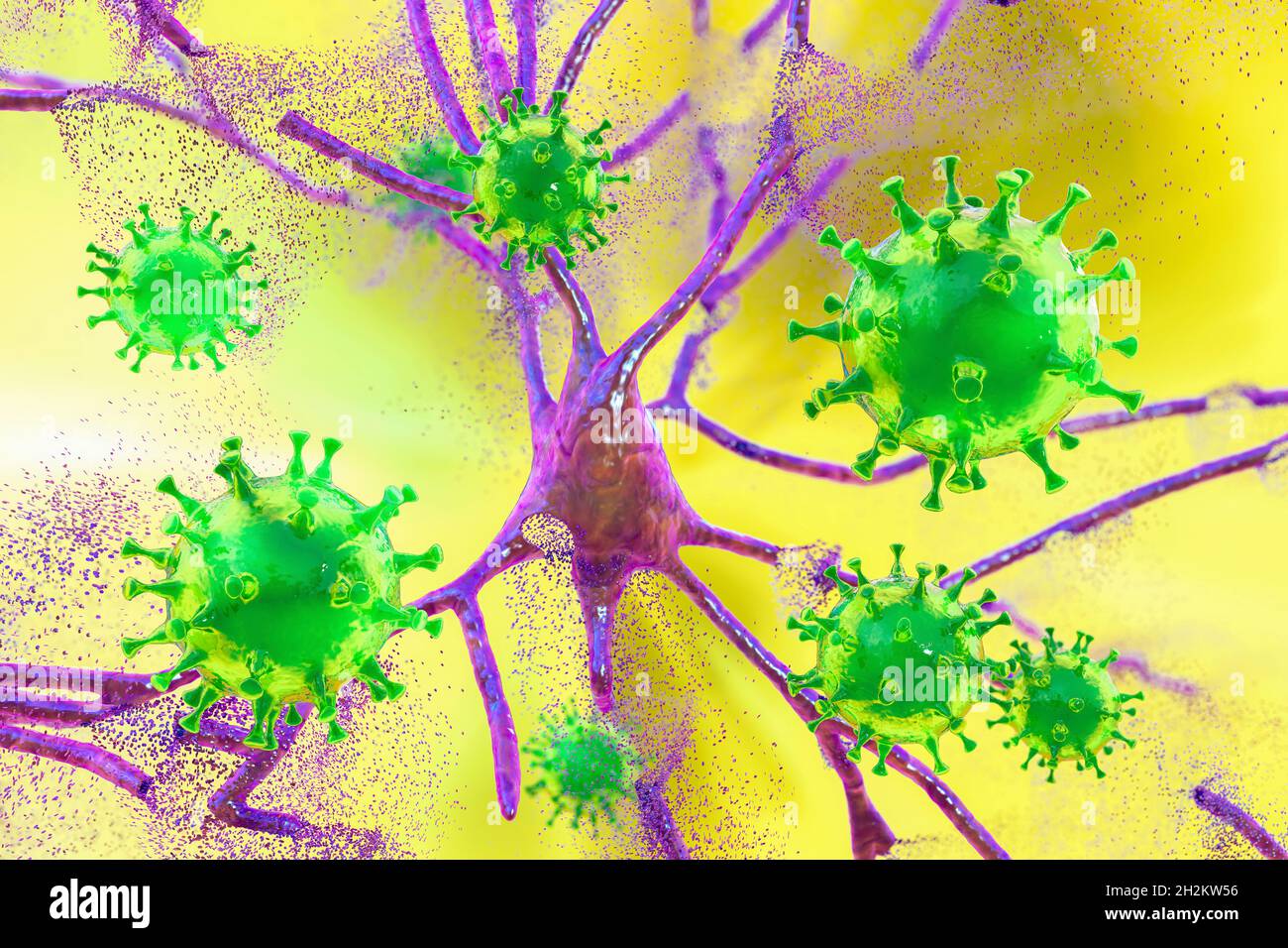 Viral encephalitis, conceptual illustration Stock Photo - Alamy