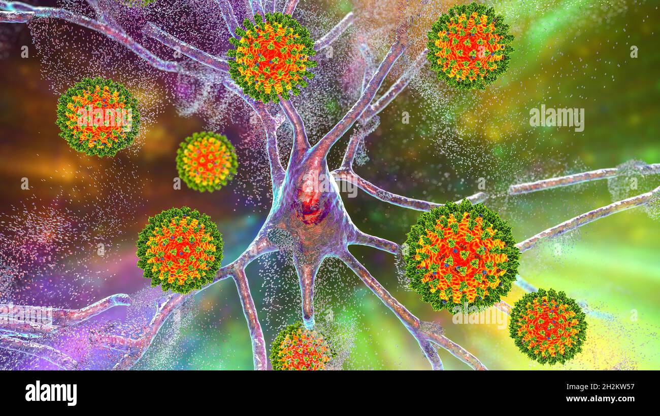 Covid-19 virus infecting nerve cells, illustration Stock Photo - Alamy