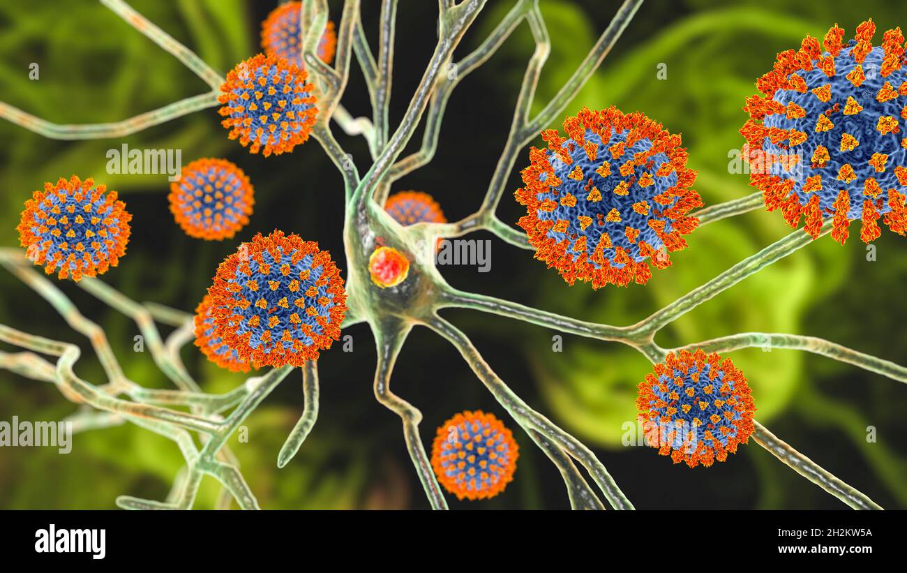 Covid-19 virus infecting nerve cells, illustration Stock Photo - Alamy