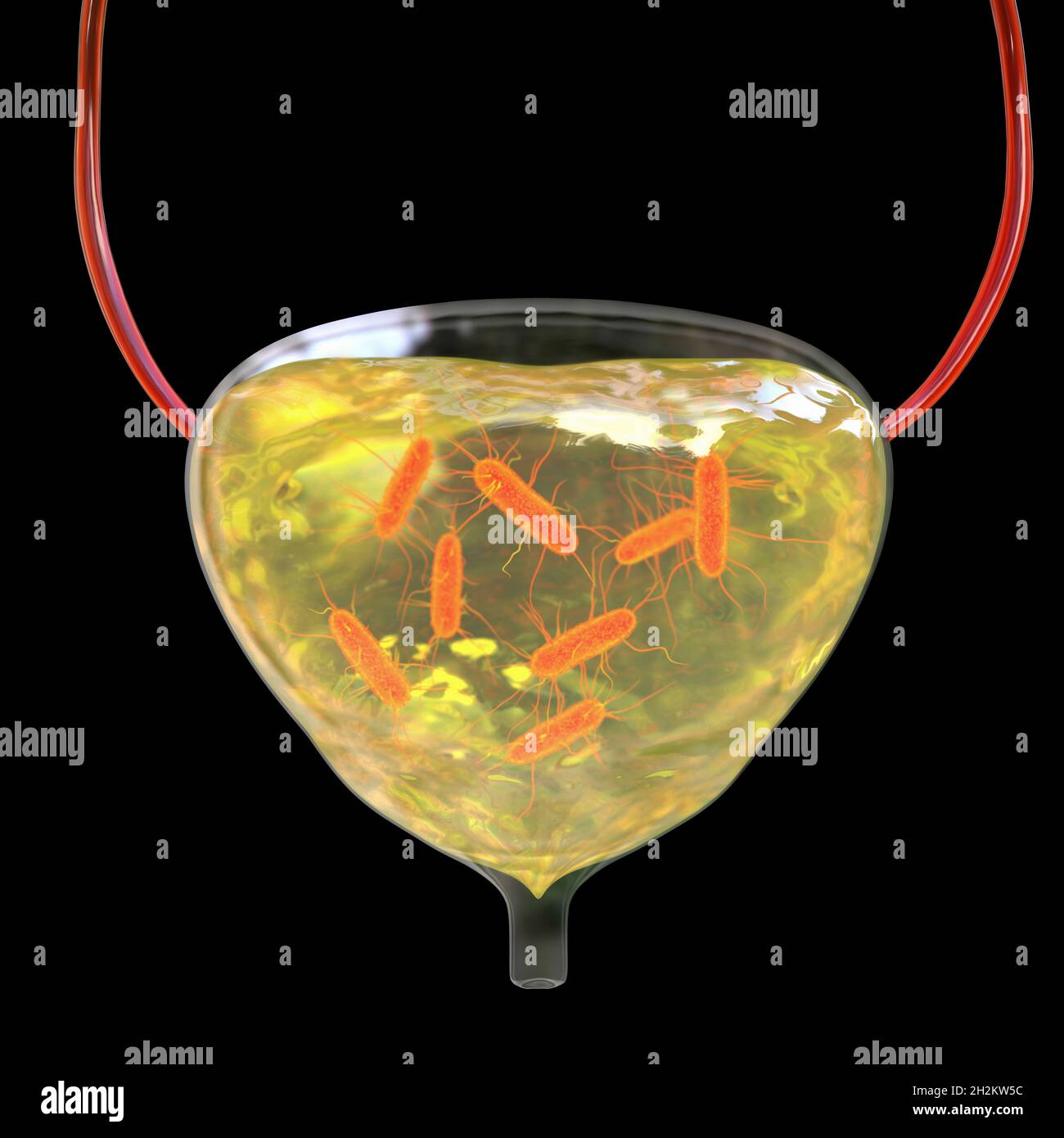 Bacterial cystitis, illustration Stock Photo - Alamy