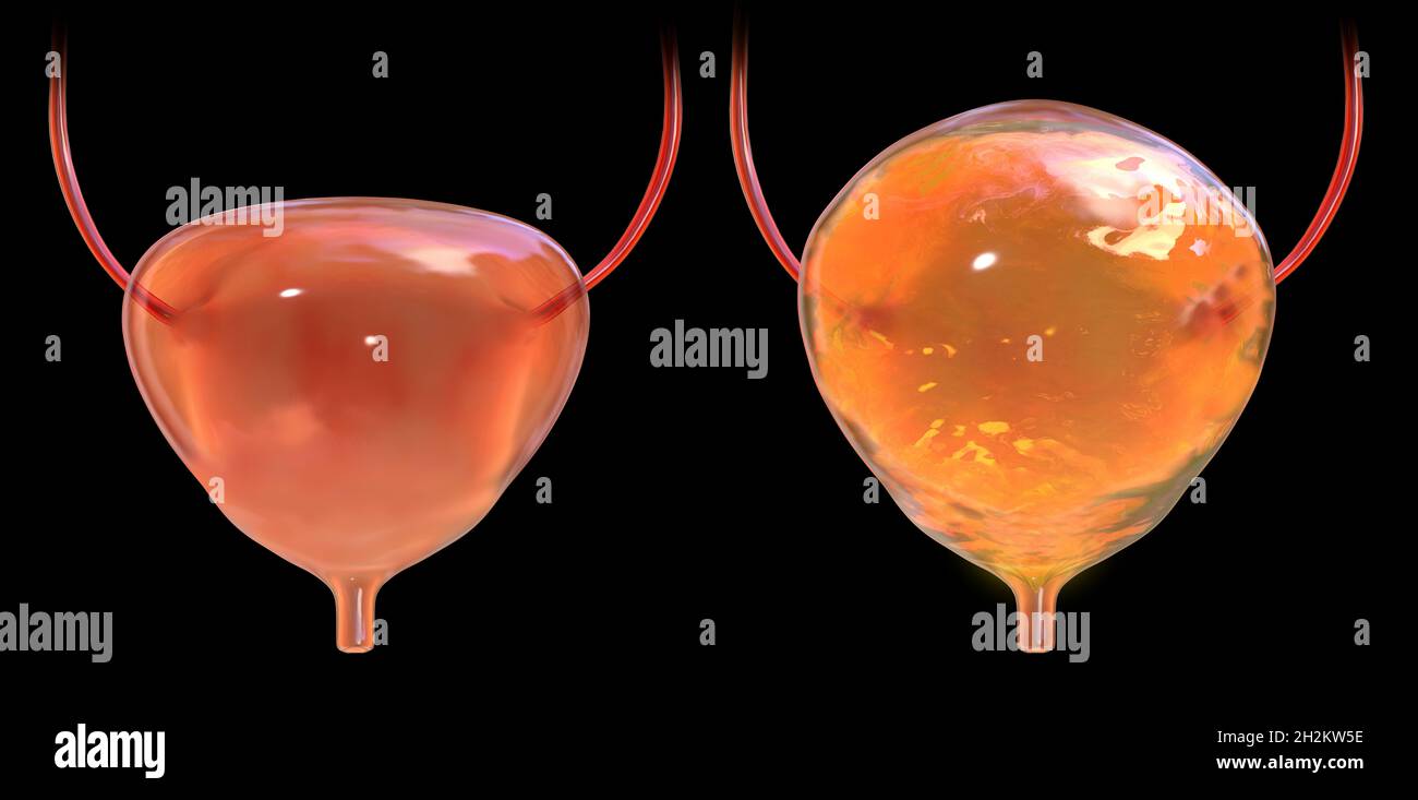 Urinary bladder, illustration Stock Photo - Alamy
