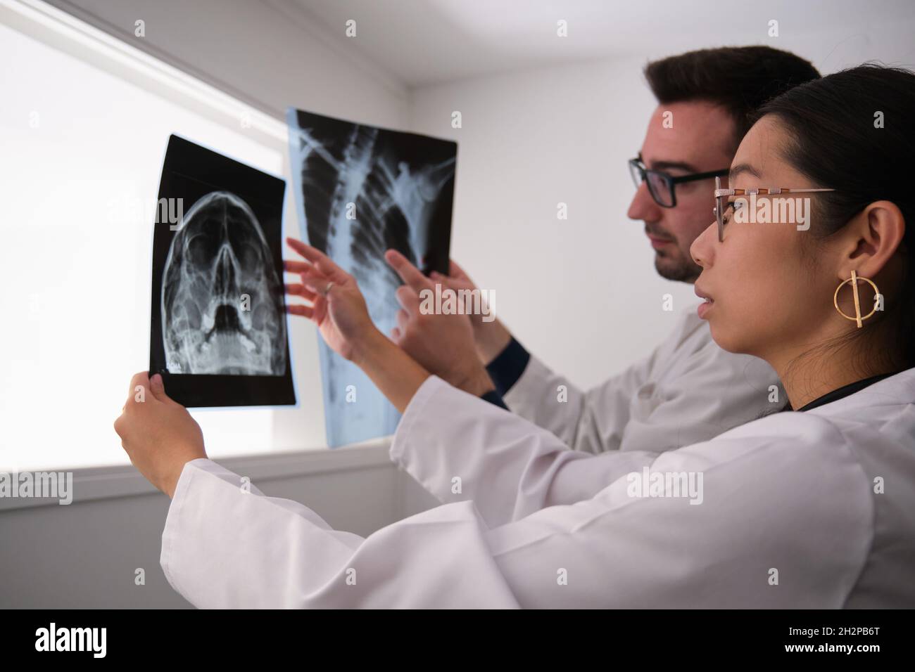 Doctor skull fracture xray hi-res stock photography and images - Alamy