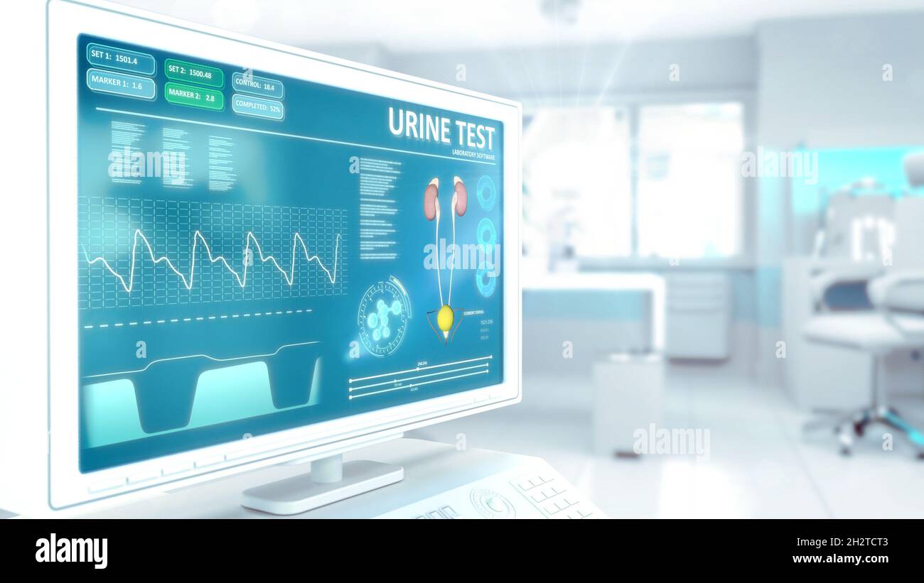 Urinalysis test hi-res stock photography and images - Alamy