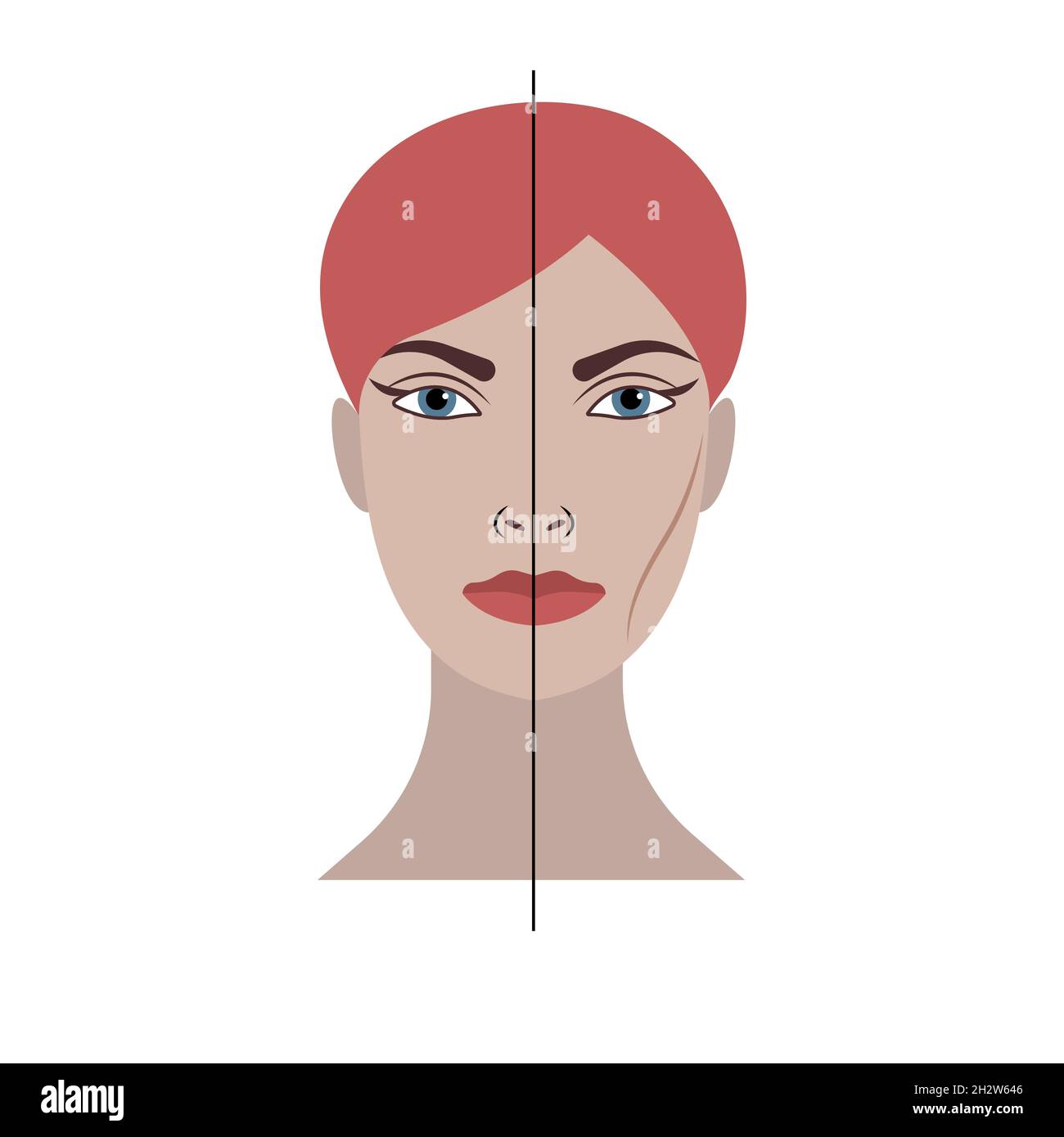 Buccal Fat Removal. Vector illustration Stock Vector Image & Art - Alamy