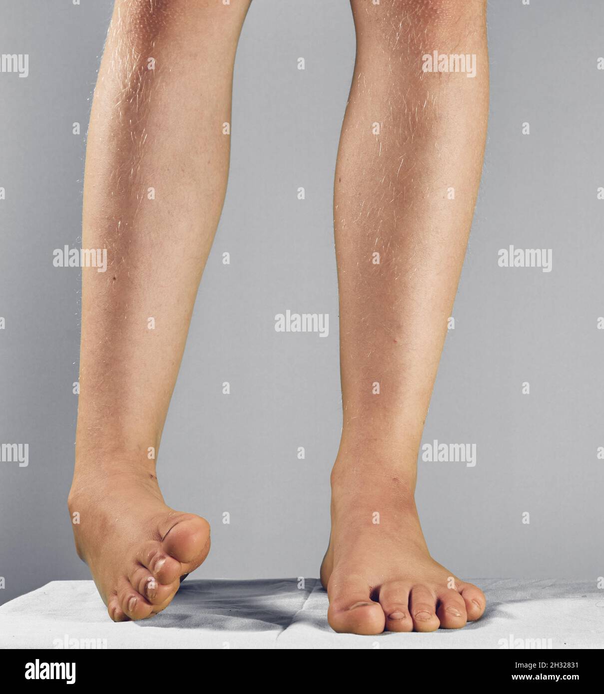 Children feet and leg barefoot Stock Photo - Alamy