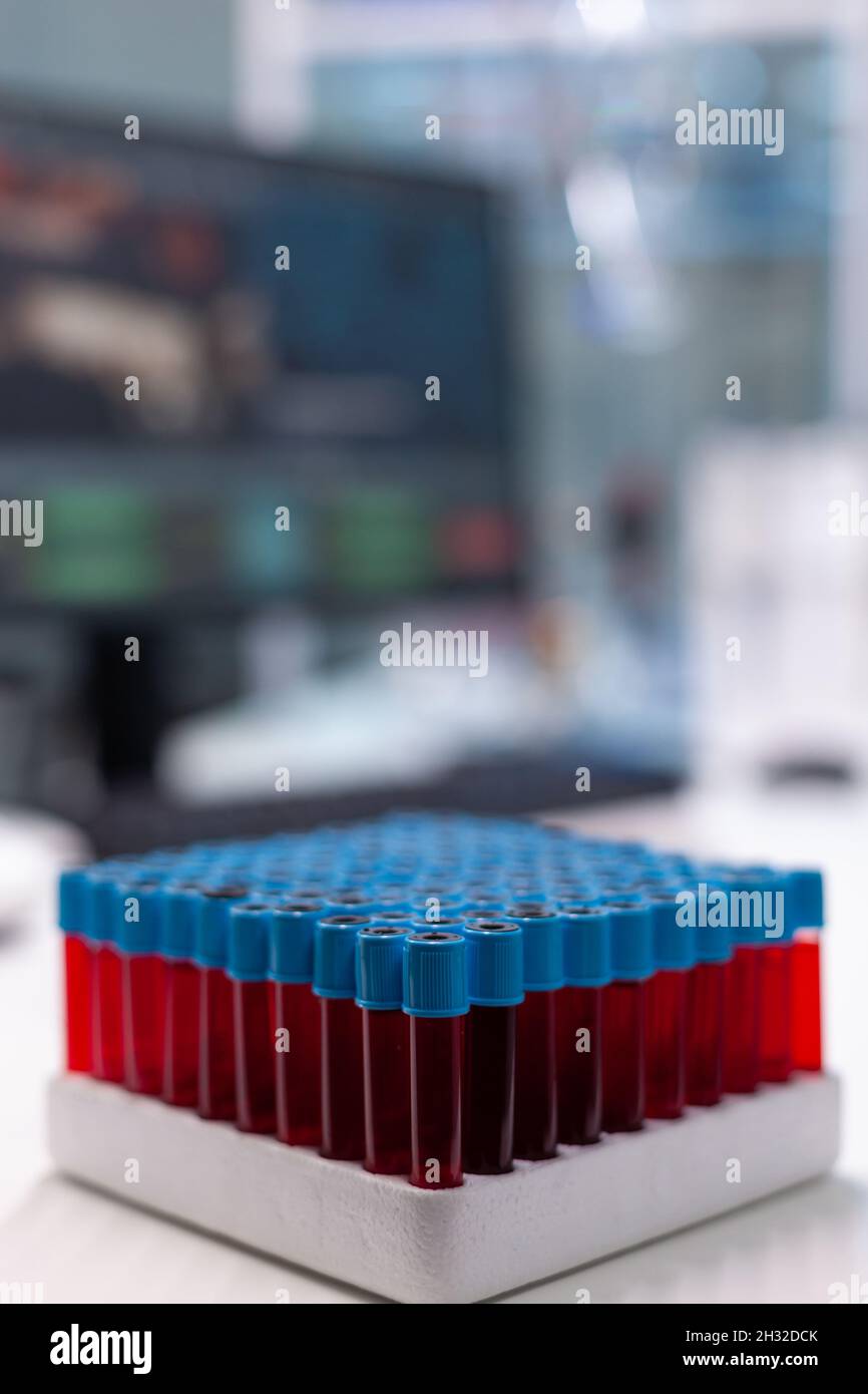 Close up of vacutainers with blood in science laboratory. Glass tubes ...