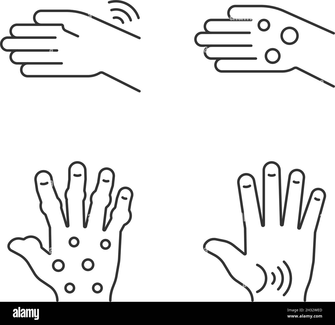 Arthritis in hands linear icons set Stock Vector Image & Art - Alamy