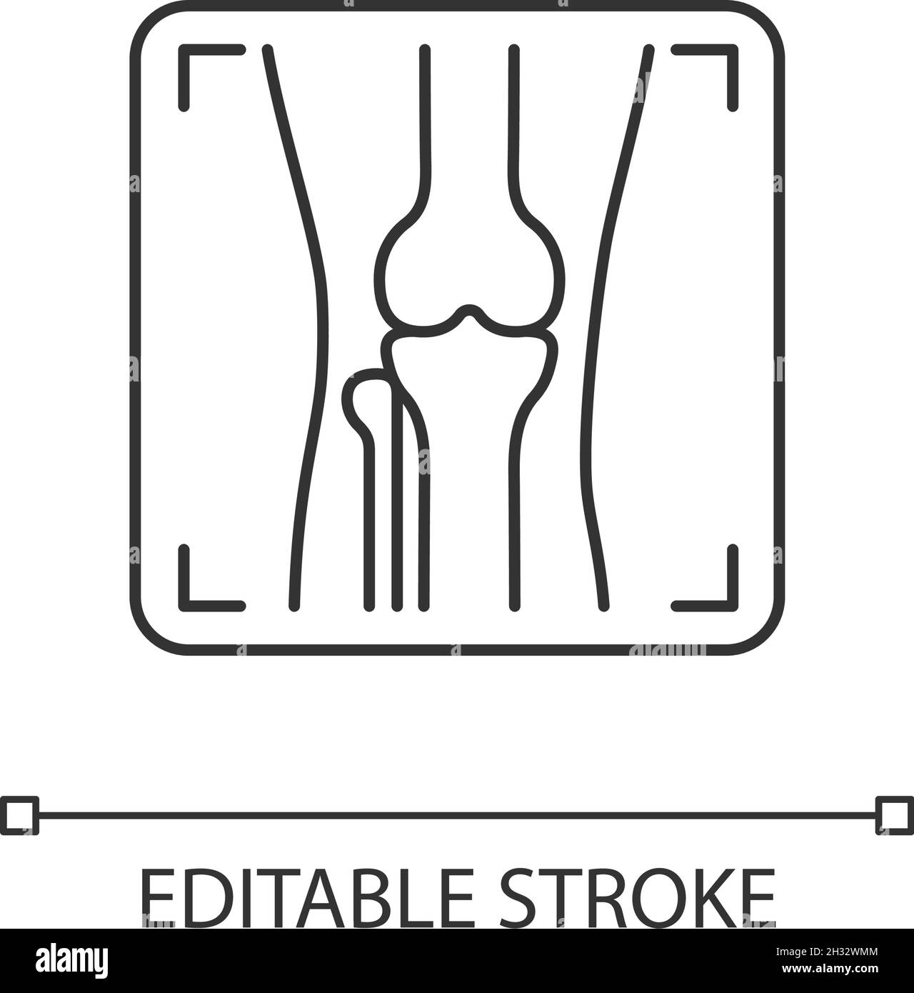 Arthritis x ray linear icon Stock Vector Image & Art - Alamy