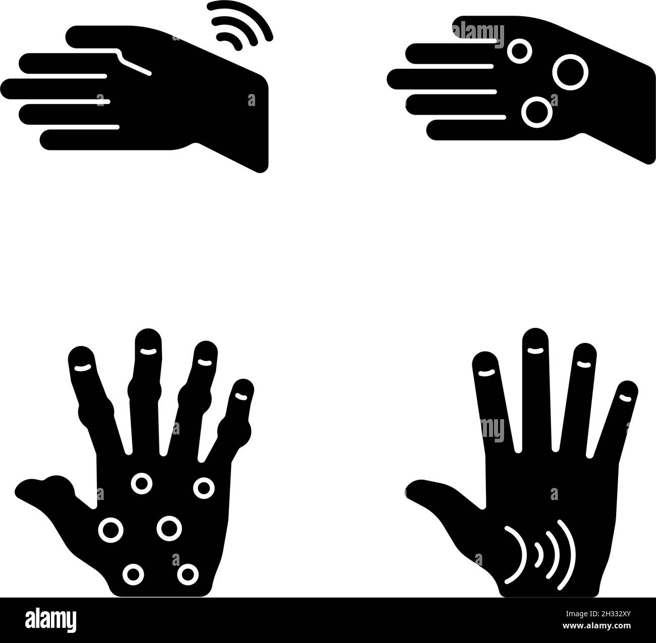 Medical illustration arthritis in hands hi-res stock photography and ...